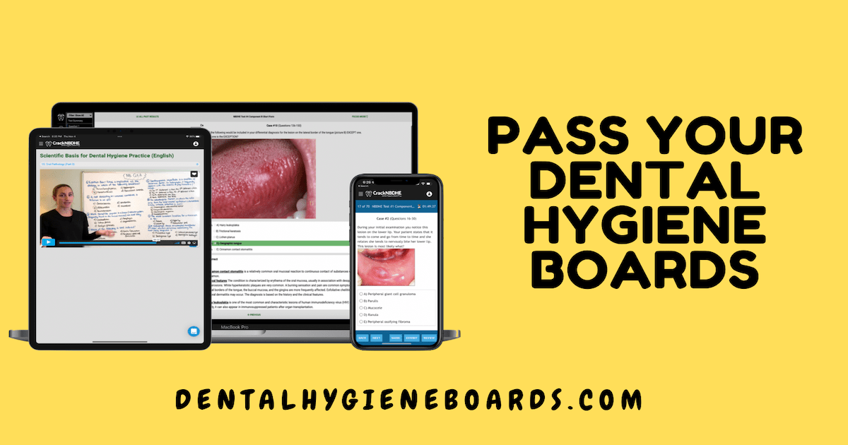 Crack the Dental Boards - #1 iNBDE Dental Boards Prep | Trusted by ...